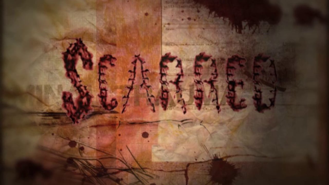 Scarred (TV Series 2007)