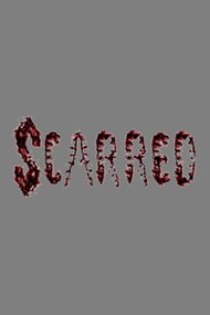 Scarred episodes (TV Series 2007)